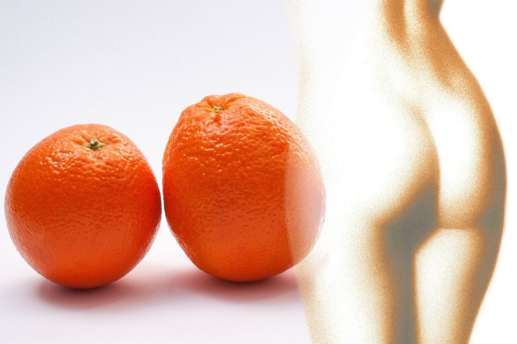 Cellulite e ritenzione idrica: le nuove strategie integrate del 2025 ...